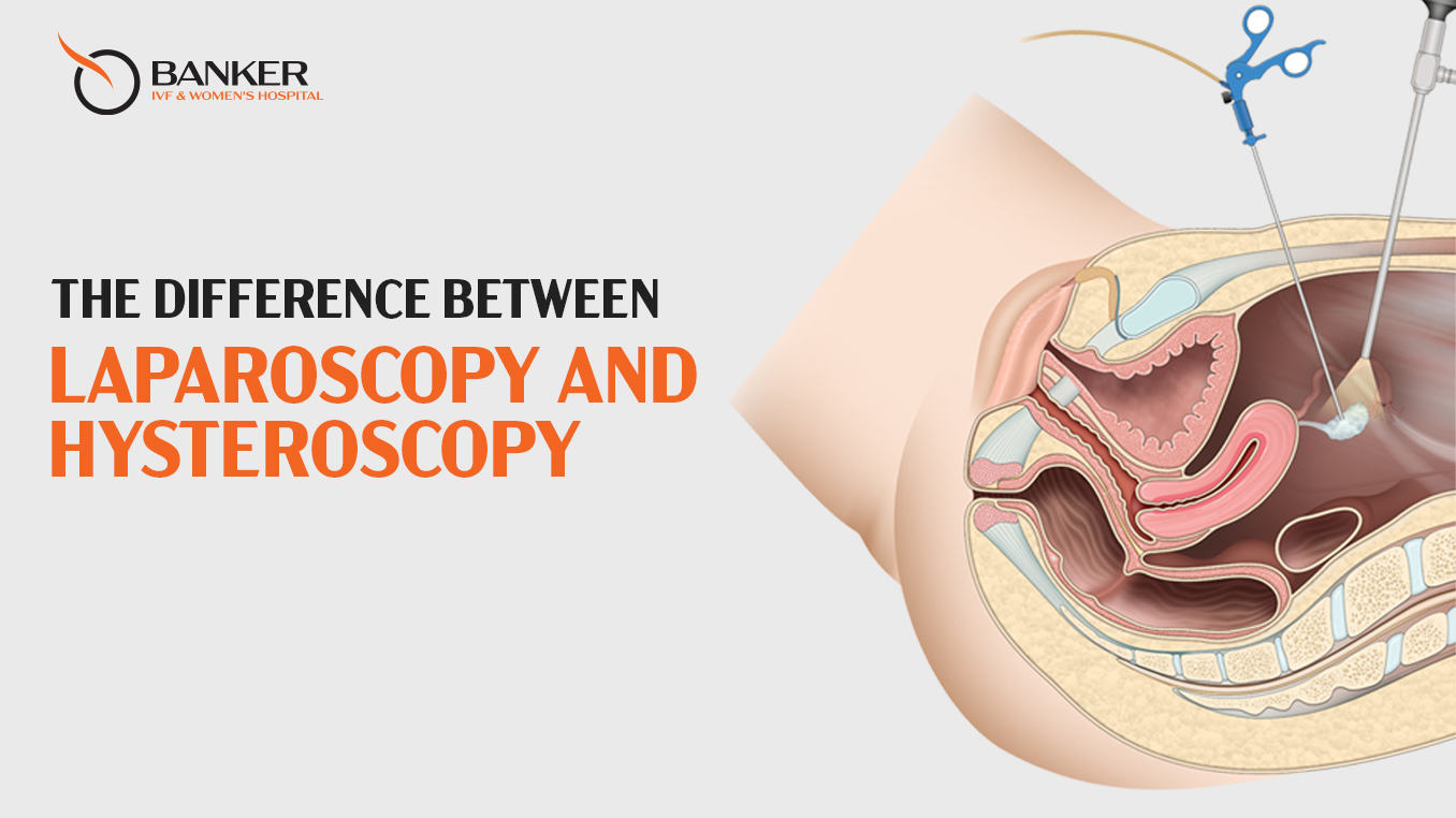 Difference Between Laparoscopy and Hysteroscopy | Banker IVF