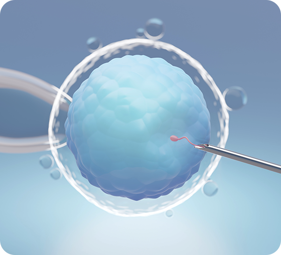 Self IVF-ICSI Treatment by Banker IVF Centre
