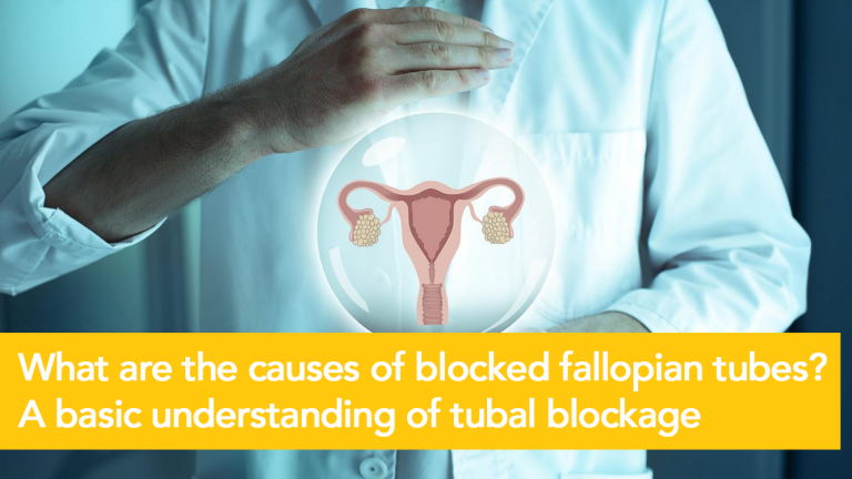Blocked Fallopian Tubes: Symptoms, Causes & Treatments