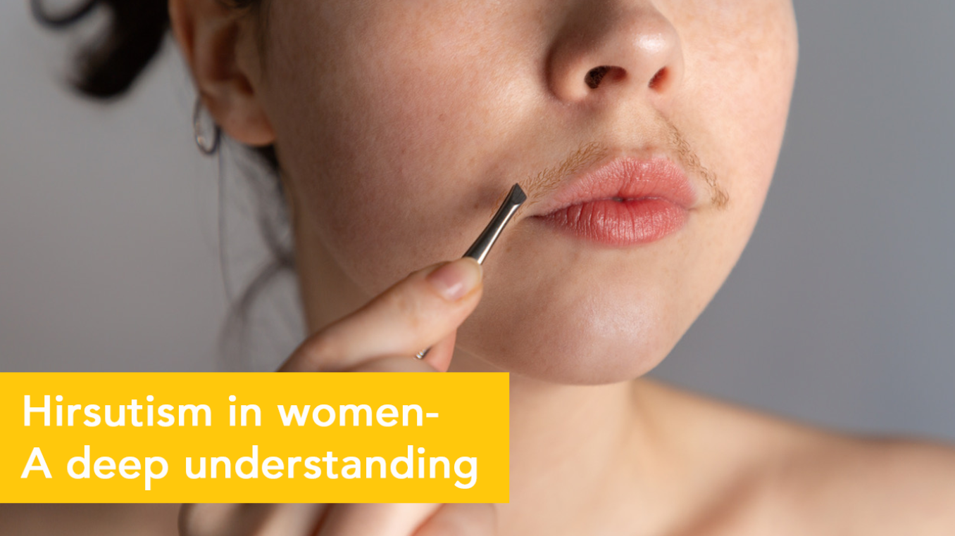 Hirsutism in women - A deep understanding | Banker IVF & Women's Hospital