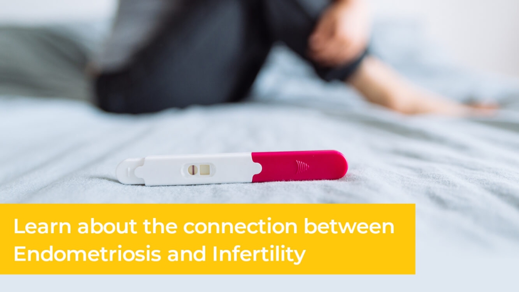 Endometriosis & Infertility: Connection between both of them - Dr. Banker